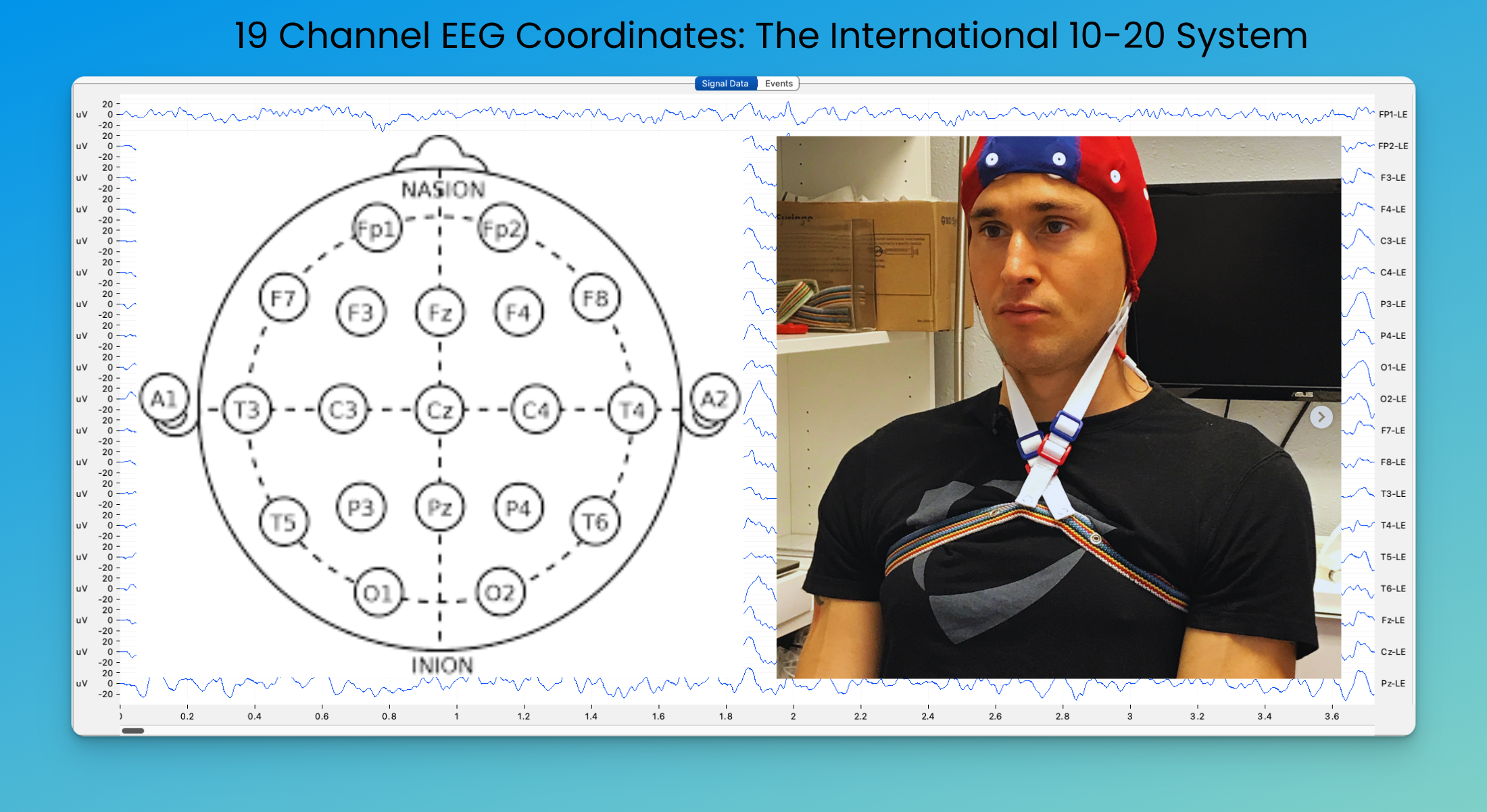 Reading Your Own QEEG Brain Map | Peak Brain Institute Blog